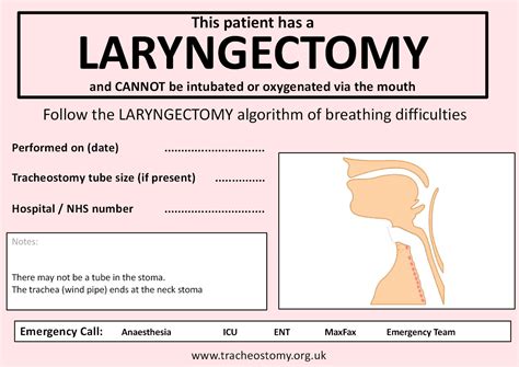Keeping Patients Safe During Emergency Tracheostomy Management Anesthesia Experts