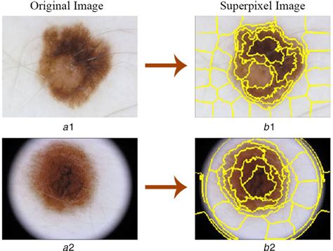 Illustrations Of The Superpixel Segmentation Results After Slic The Download Scientific