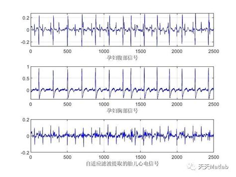 基于nlms算法实现孕妇胎儿心电信号提取附matlab代码 干货满满，直接运行 Csdn博客