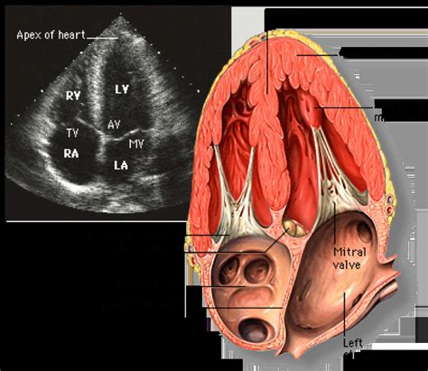 Echocardiogram Report