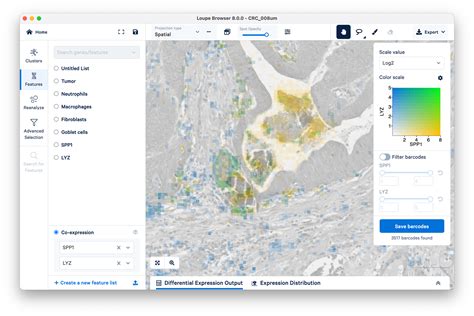 Mapping The Tumor Microenvironment With Visium Hd And Loupe Browser 10x Genomics