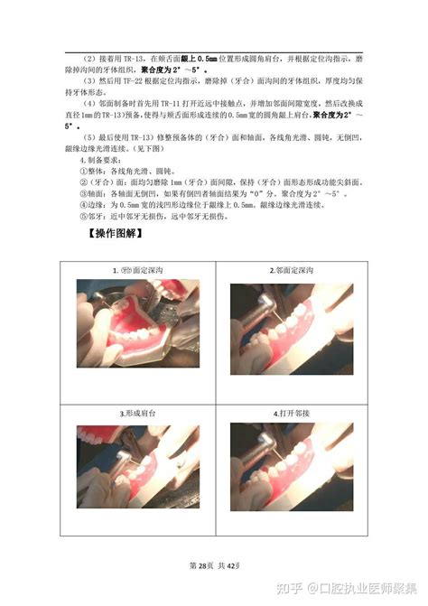 [玫瑰][庆祝][玫瑰][庆祝][玫瑰] 口腔技能考试 技能图解 知乎