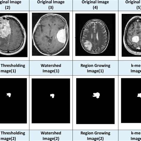Basic Steps Diagram Of Brain Tumor Detection Download Scientific Diagram