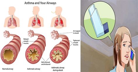 How To Calm An Asthma Attack At Tammy Pough Blog
