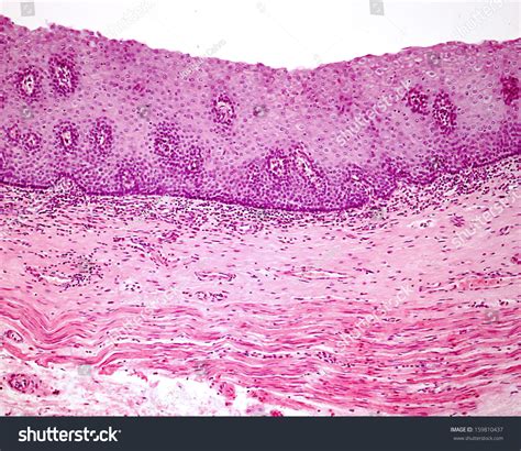 Keratinized Stratified Squamous Epithelium The Simple Stratified
