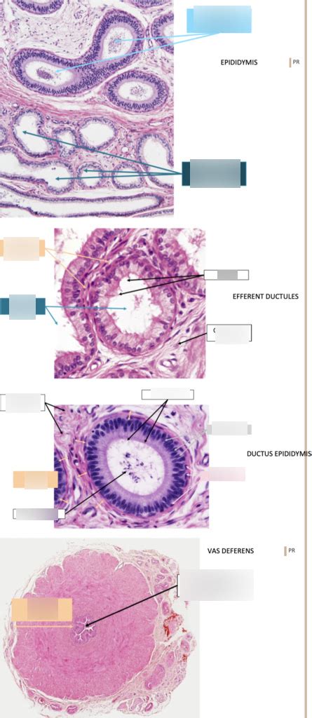 Diagram Of Histology Of Epididymis And Vas Deferens Quizlet
