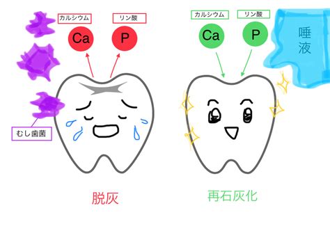 脱灰と再石灰化について 福岡天神矯正歯科