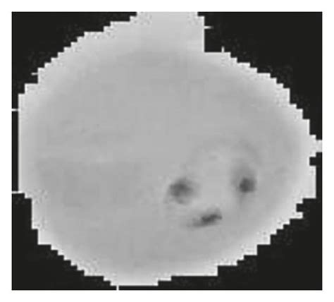 Infected Kernel Sample Infected Greyscale And An Output Image That Is