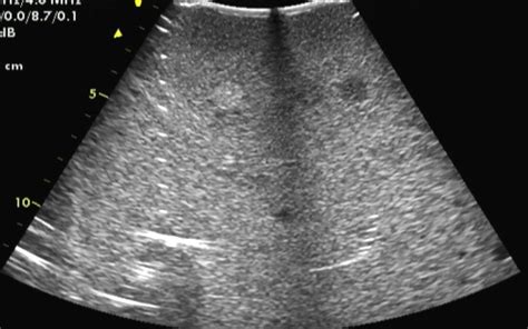 [sponsored] 20 20 Imaging Insights Field Testing Of Ultrasound Probes Technation