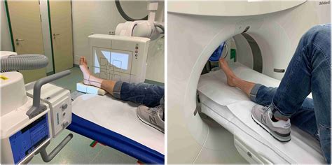 3d Cone Beam Ct Of The Ankle Using A Novel Twin Robotic X Ray System