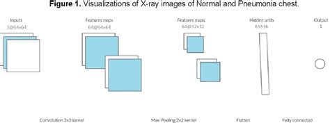 Figure 1 From Explanation Of The Convolutional Neural Network Classifying Chest X Ray Images
