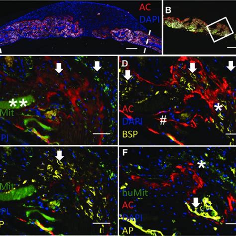 Substantial Mouse Calvarial Bone Defect Regeneration Was Observed