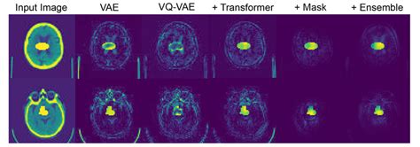 Residual Maps On The Synthetic Dataset From The Variational Autoencoder