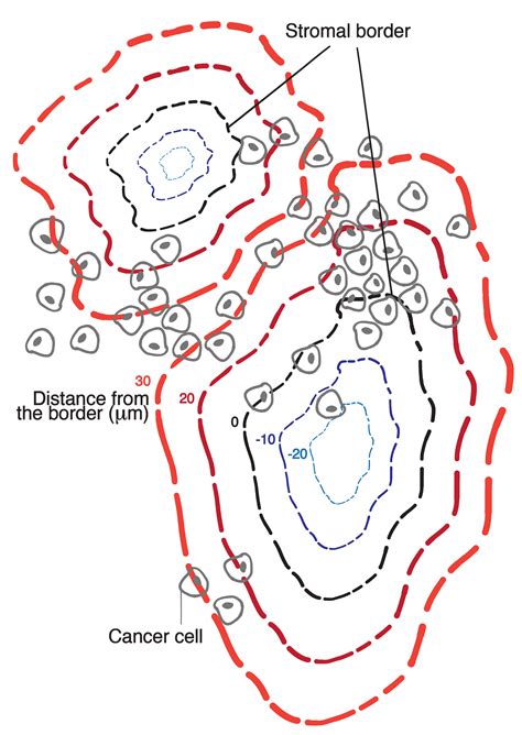An Image Analysis Pipeline To Quantify The Spatial Distribution Of Cell Markers In Stroma Rich