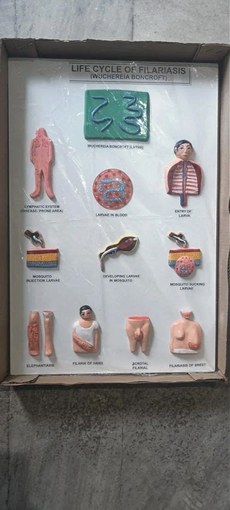 Filariasis Life Cycle Pathology Model At ₹ 2500 In Ambala Id