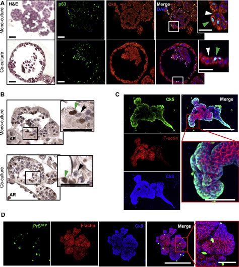 Prostate Stroma Increases The Viability And Maintains The Branching