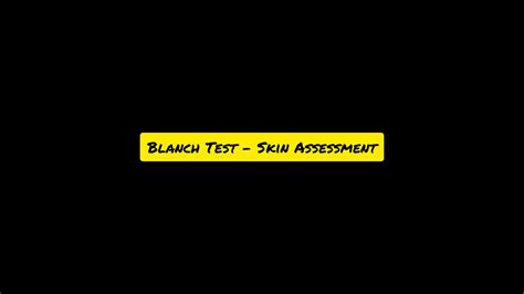 How To Perform A Blanch Test Skin Assessment Youtube