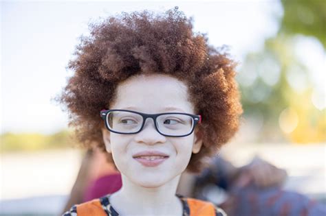 행복함 하위 세로는 알비노에 대한 스톡 사진 및 기타 이미지 알비노 아프리카계 미국 민족 흑인 민족 Istock