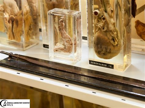 Fixation Ideal Fixative Factors Involved In Fixation Medical Laboratory Scientist Mls