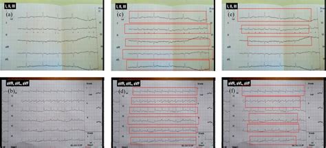 A And B Input Images That Were Fed Into The Yolov3 And Yolov4 Models