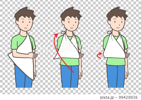 How To Use Triangular Bandage With Arrow Male Stock Illustration 99428916 PIXTA