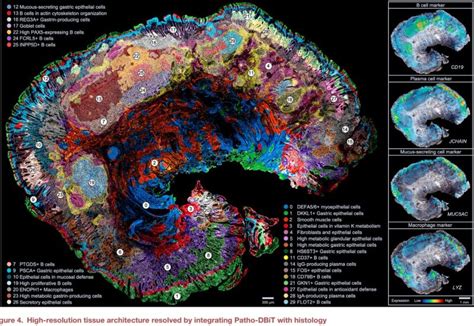 Spatially Exploring Rna Biology In Archival Formalin Fixed Paraffin Embedded Tissues Holds The
