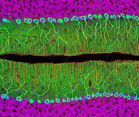 Purkinje Nerve Cells In The Cerebellum Stock Image P3600473