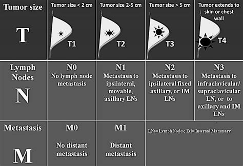 Tnm And Staging Of Breast Cancer Simplified Epomedicine 57 Off