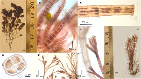 Vegetative And Reproductive Structures Of Polysiphonia Determinata