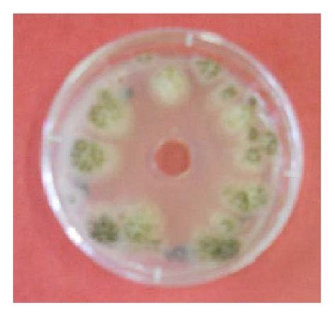 Visualization Of The Inhibition Zones In The Plate Diffusion Test For