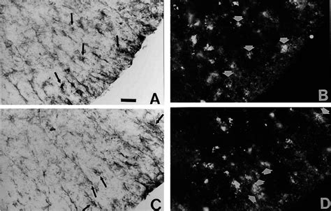 Astrocyte Infection Shown Using Simultaneous Detection Of Gfap And Mhv Download Scientific