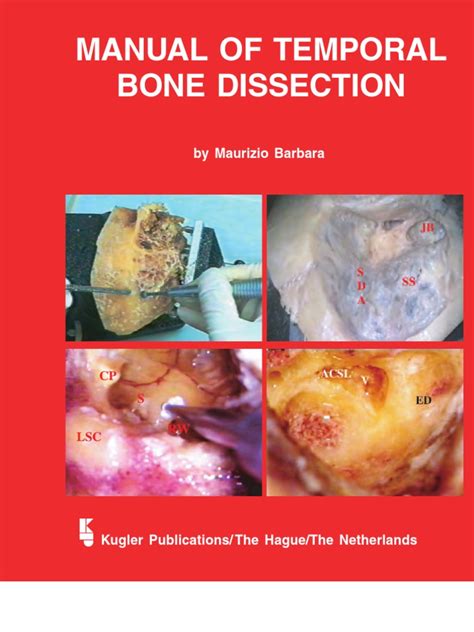 Manual Of Temporal Bone Dissection Download Free Pdf Ear Anatomical Terms Of Location