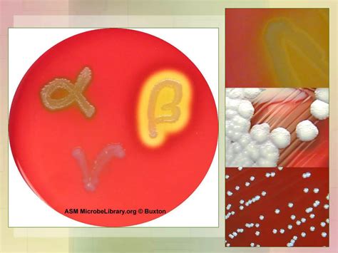 Streptococcus And Enterococcus By Dr Rakesh Prasad Sah Pptx
