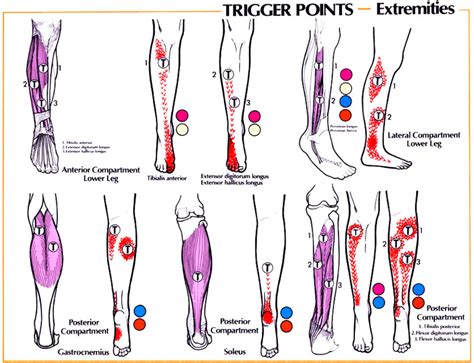 Leg Trigger Points Chart