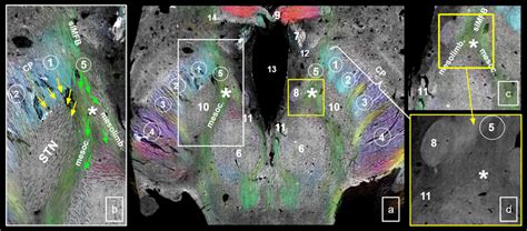 Midbrain Ventral Tegmentum And Adjacent Hypothalamus And Cerebral Download Scientific Diagram