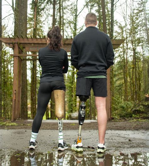 New Bern Custom Prosthetic Limbs New Bern Prosthetic Hip Joints New Bern Prosthetic Ankles