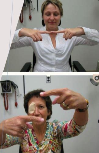 15 Functional Vision Loss Flashcards Quizlet