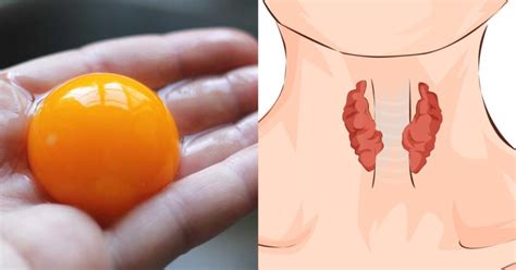 ენდოკრინოლოგი ფარისებრი ჯირკვლის პრობლემების დროს მიირთვით მინიმუმ 1 კვერცხის გული ყოველდღიურად