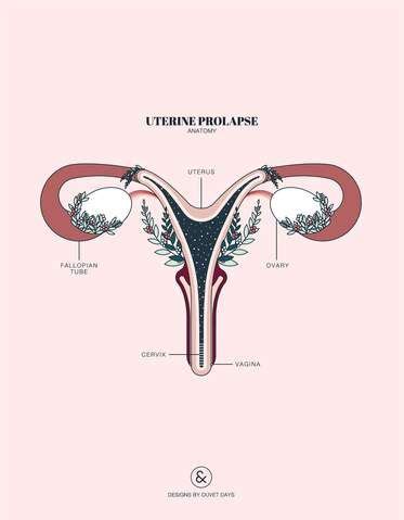 Why Is Sex Painful Pt I Artofit