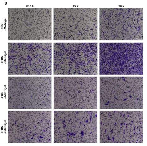 Cell Migration And Invasion Assay Guidance Using Millicell® Cell Culture Inserts