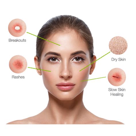 How Stress Can Affect Your Skin Results Laser Clinic