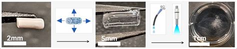 Hydrogel Implant To Treat Endometriosis Mirage News