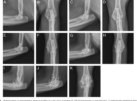 Structure Of Appendicular Lymph Node Semantic Scholar