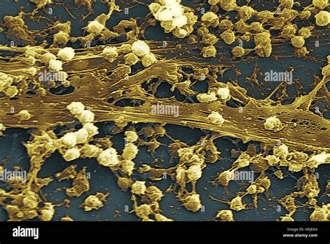Staphylococcus Aureus Bacteria SEM Stock Photo Alamy