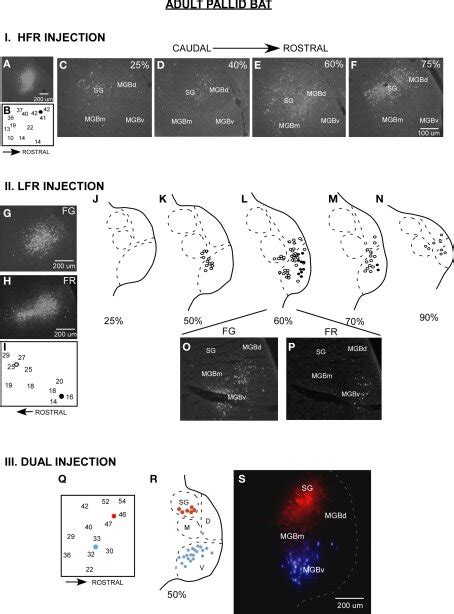 Parallel Thalamocortical Pathways In The Adult Pallid Bat Auditory
