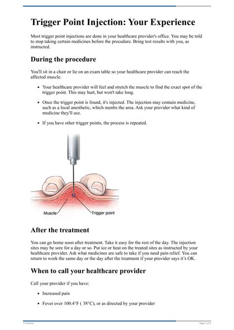 Text Trigger Point Injection Your Experience HealthClips Online
