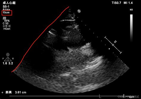 Dcm文件us设备类型的像素处理physical Delta X Csdn博客