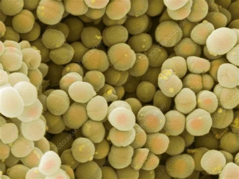 Lactococcus Sp Bacteria Sem Stock Image C014 9334 Science Photo Library