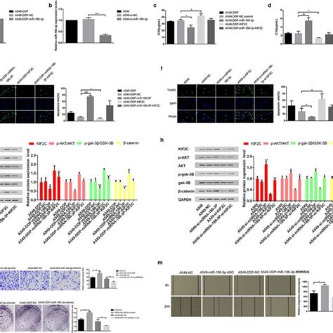 The Effects Of Kif2c On The Proliferation Migration Invasion And