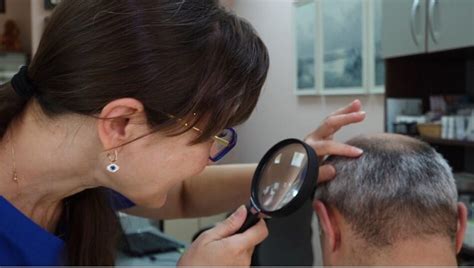 Пациент от Плевен и неговият дерматолог станаха герои във филм за псориазиса Вестник Посредник